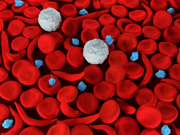 FDA Concerns About Cancer Risk Sink Fulcrum Therapeutics’ Sickle Cell ...